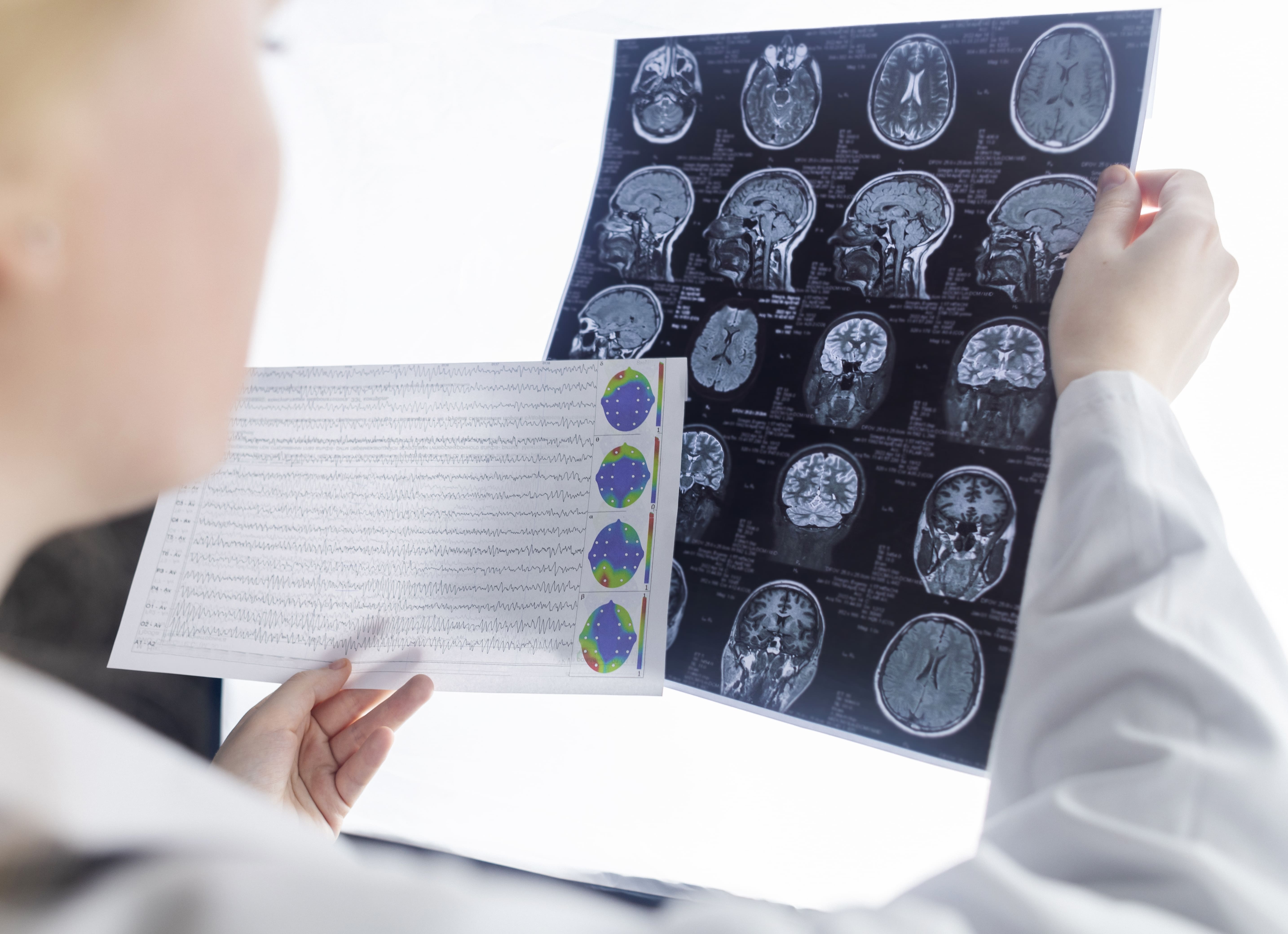 Maestría Oficial en Neurociencia | VIU