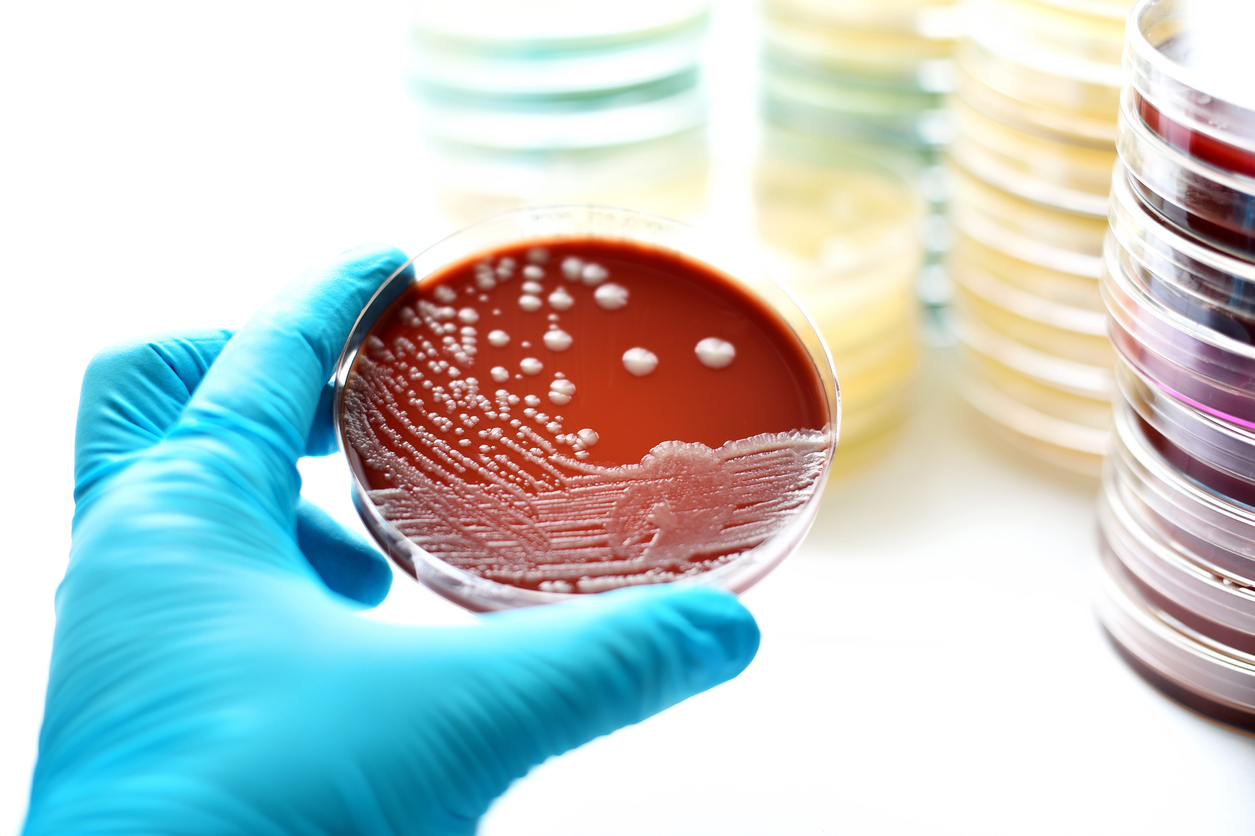 ¿Infección o intoxicación? Conociendo la toxiinfección alimentaria ...
